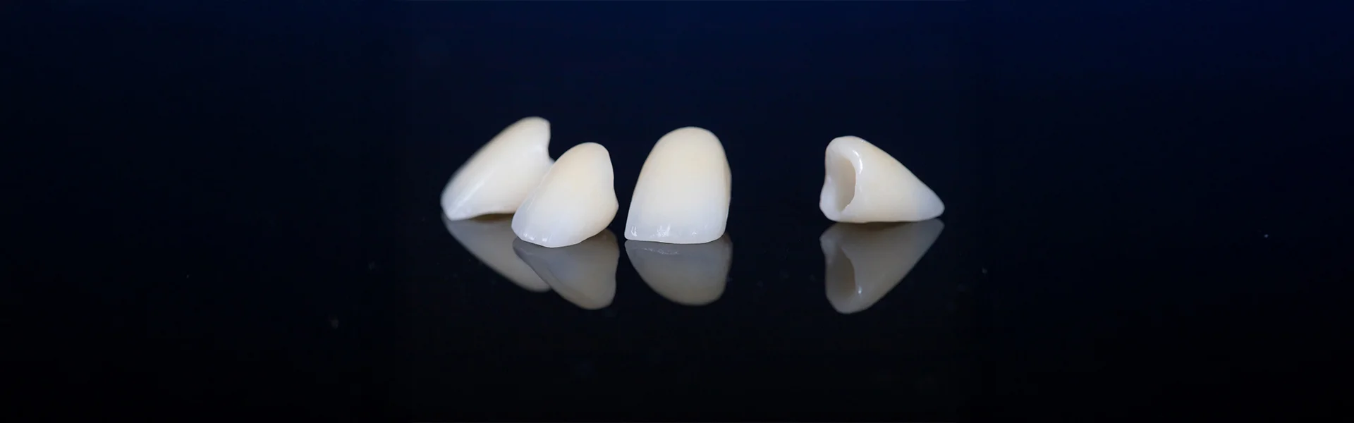 Can a Crowned Tooth Get a Cavity? What You Need to Know